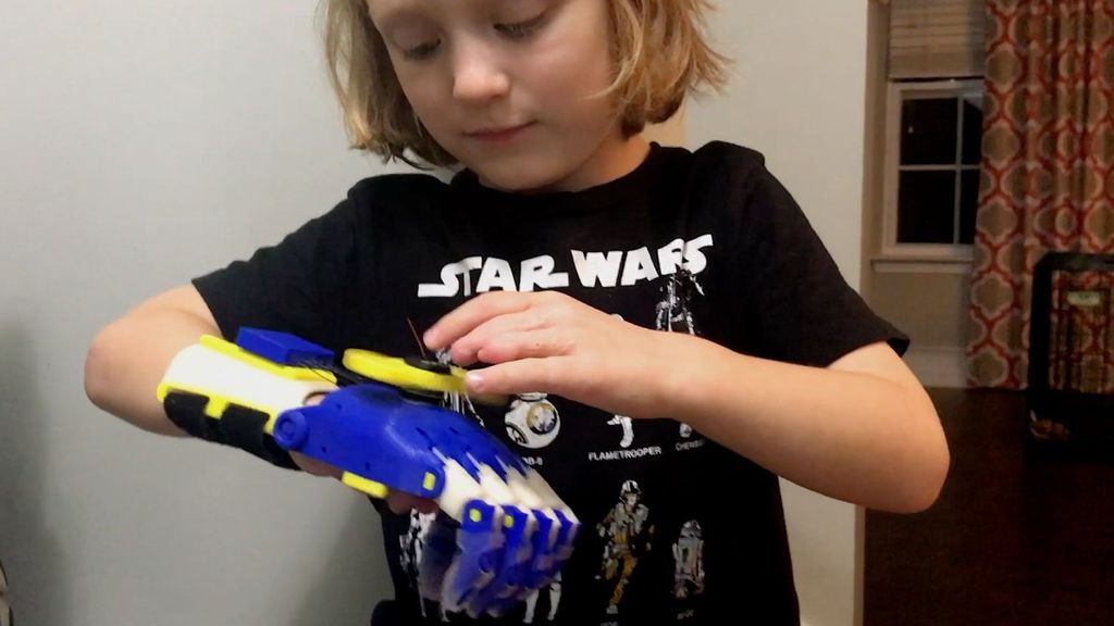 The children getting personalised 3D-printed hands - BBC Reel