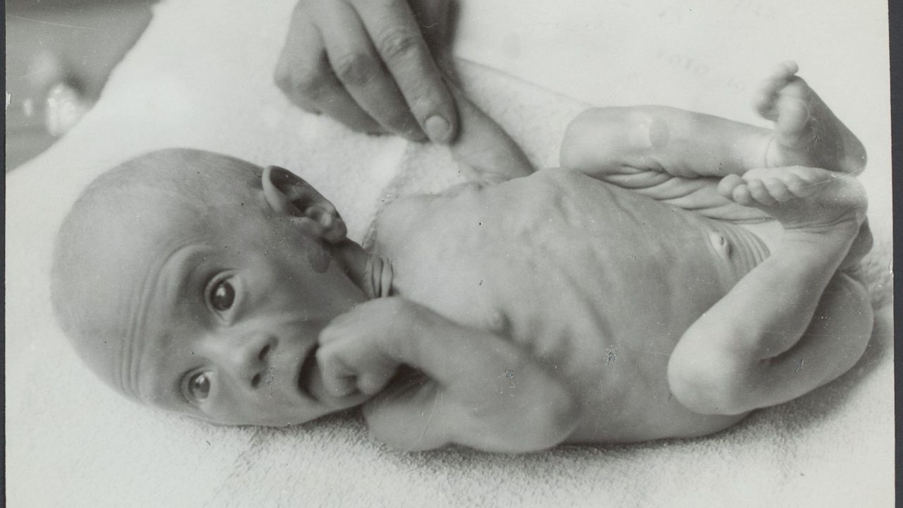 The truth about supplements and who should be taking them - BBC Reel