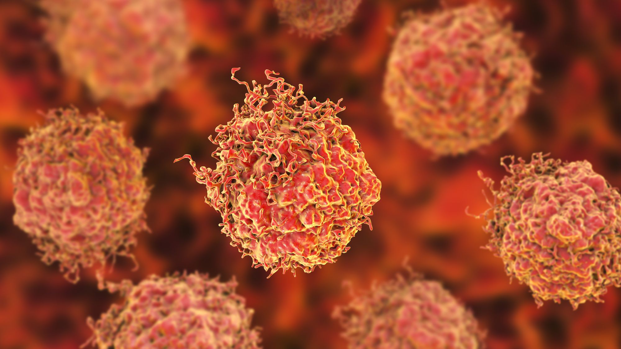 Breaking Through in Advanced Prostate Cancer