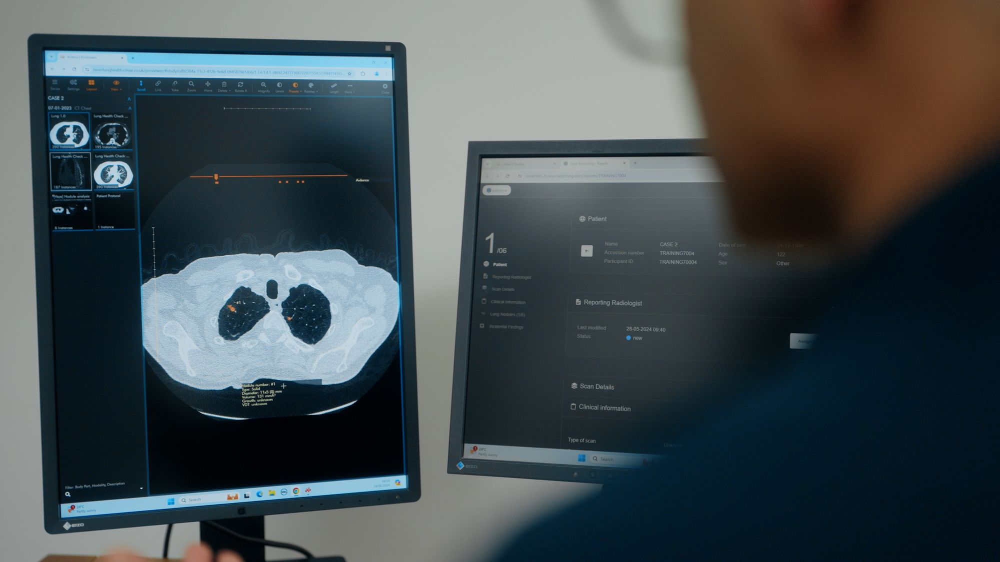 The AI reimagining cancer screening