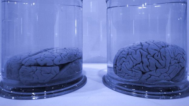 Autism: Banking on new brain donors