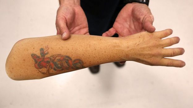 Will we ever… regenerate limbs?