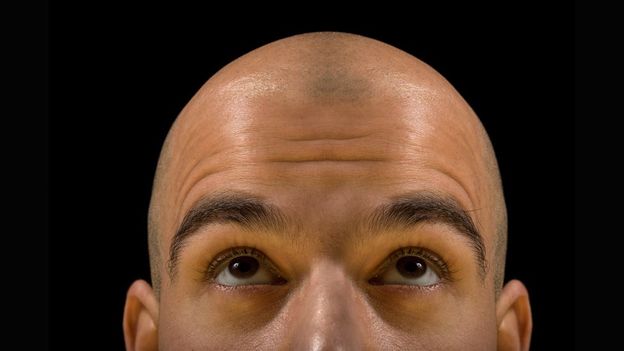 Will we ever... banish baldness?