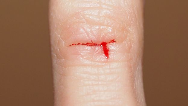 Why paper cuts are as painful as they are