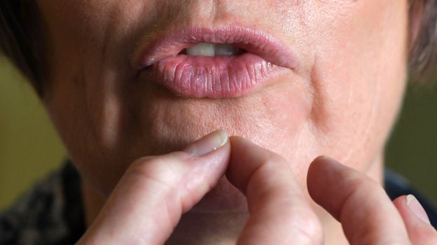 The mysterious cause of stuttering in the brain