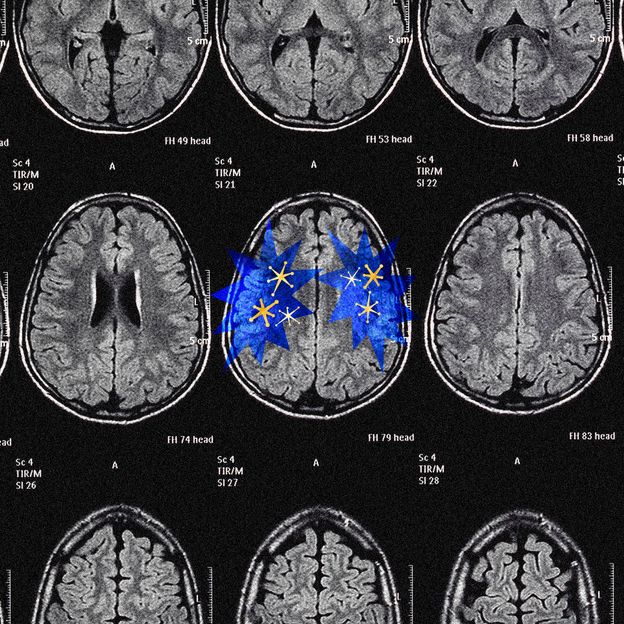 What we get wrong about dopamine - BBC Future