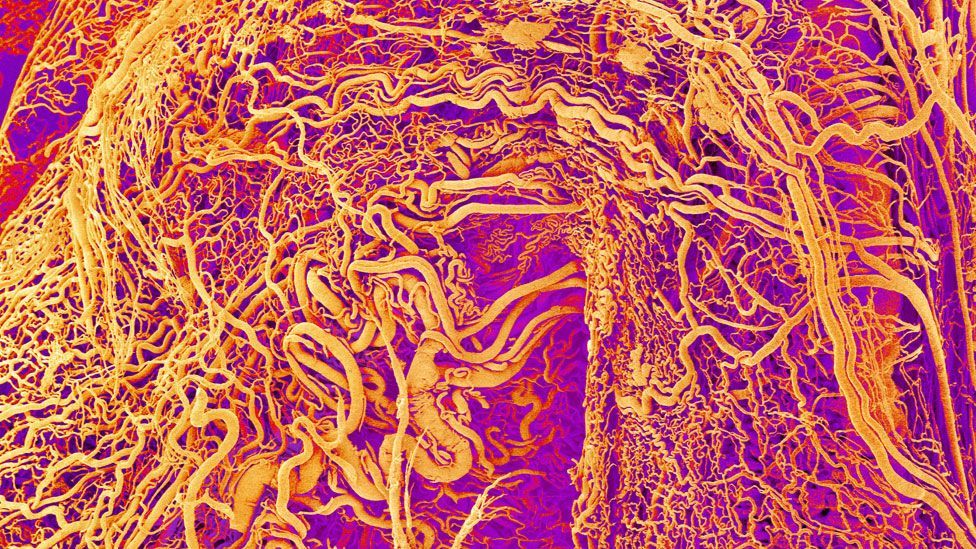 The bleeding edge of self-healing skin-like materials - BBC Future