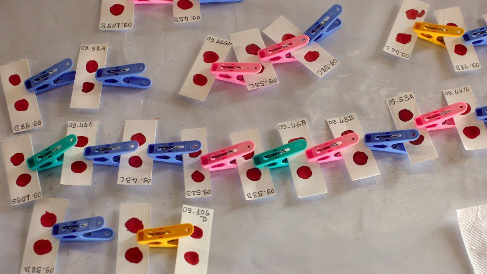 How malaria defeats our drugs - BBC Future