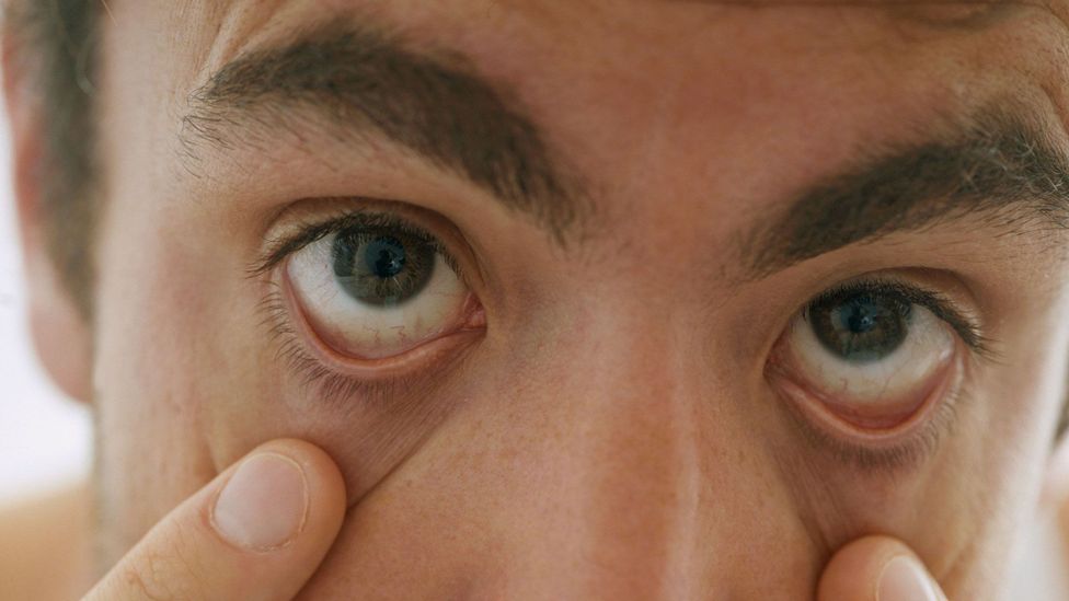 What’s the secret to dodging hangovers? - BBC Future