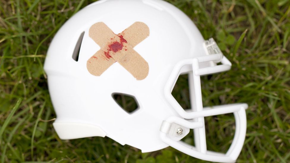 Should you let someone with concussion fall asleep? - BBC Future