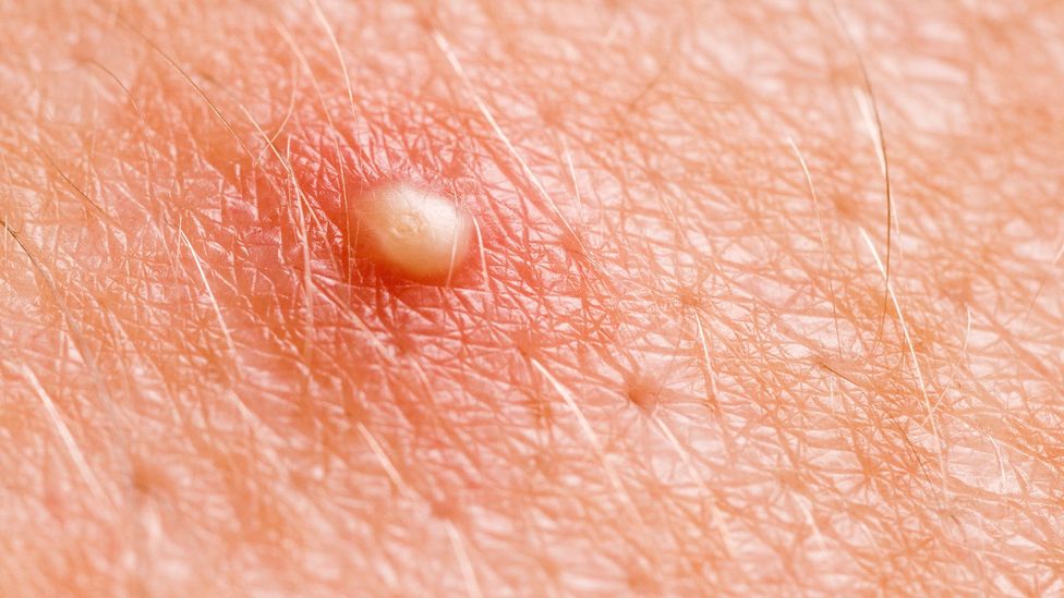 Trust Me, I'm a Doctor - BBC Future