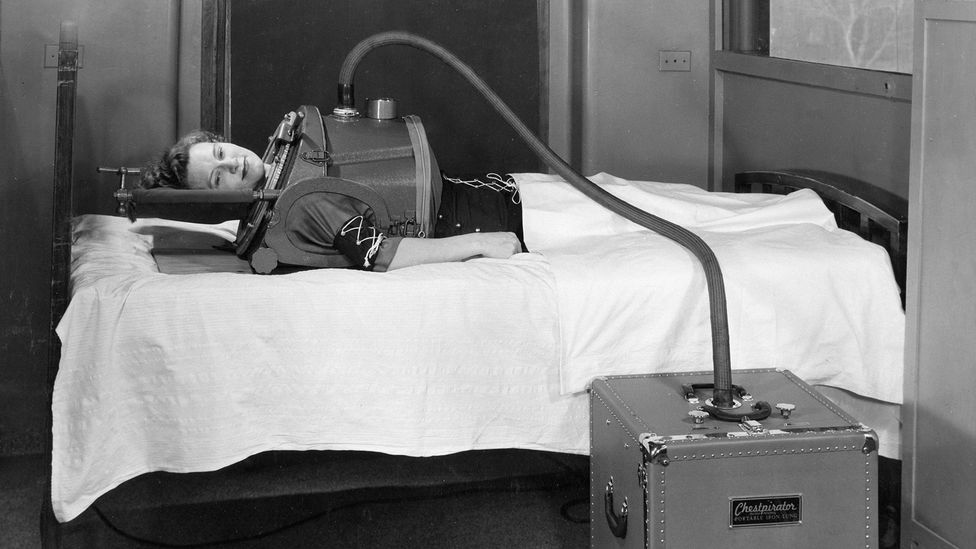 How the iron lung paved the way for the modern-day intensive care unit ...